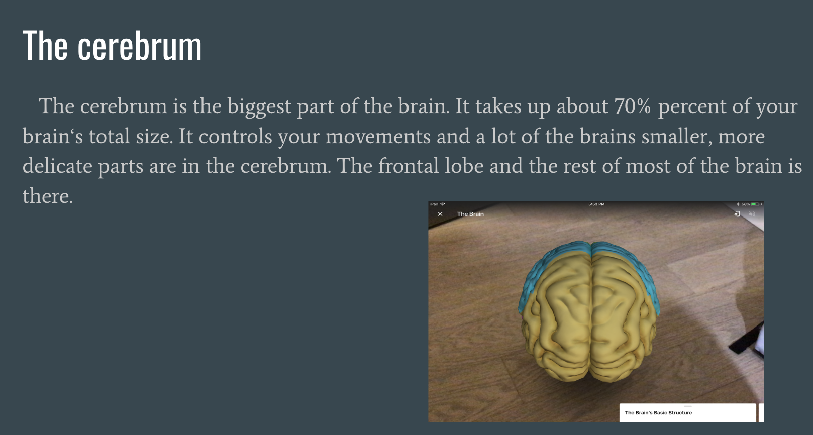 Exploring the brain – Joe Teft